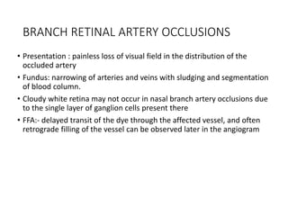 Retinal artery occlusion | PPTX