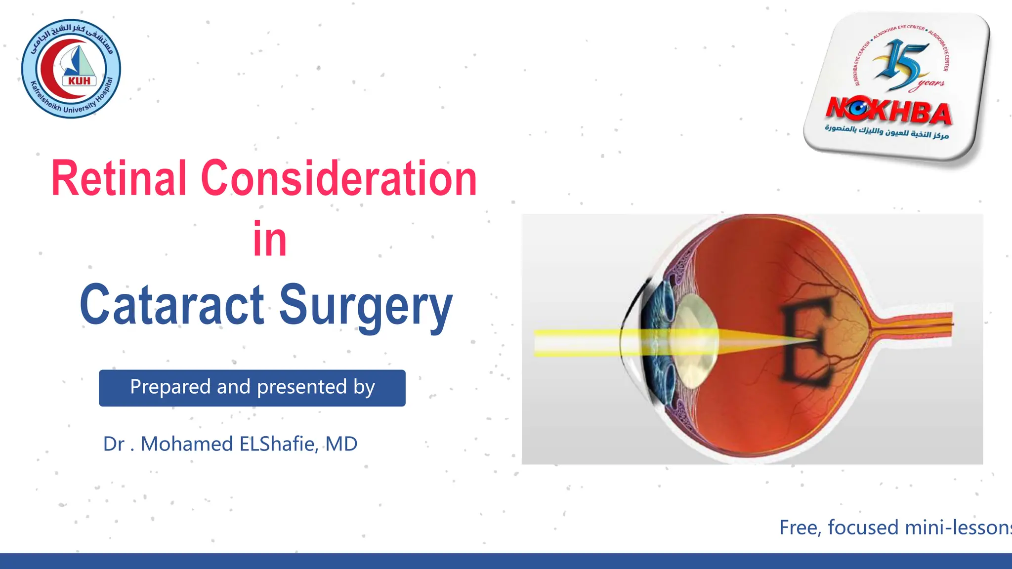 Retinal consideration in cataract surgery | PPTX