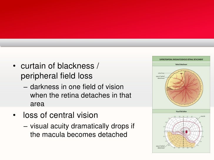 Retinal detachment