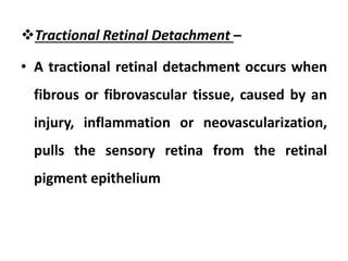 Retinal detachment | PPT
