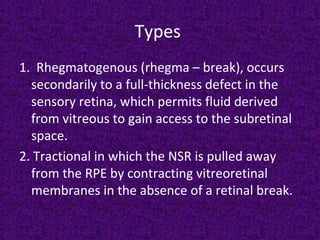 Retinal detachment | PPT