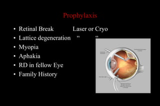 Retinal detachment | PDF