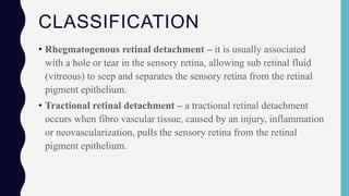 Retinal detachment | PPTX