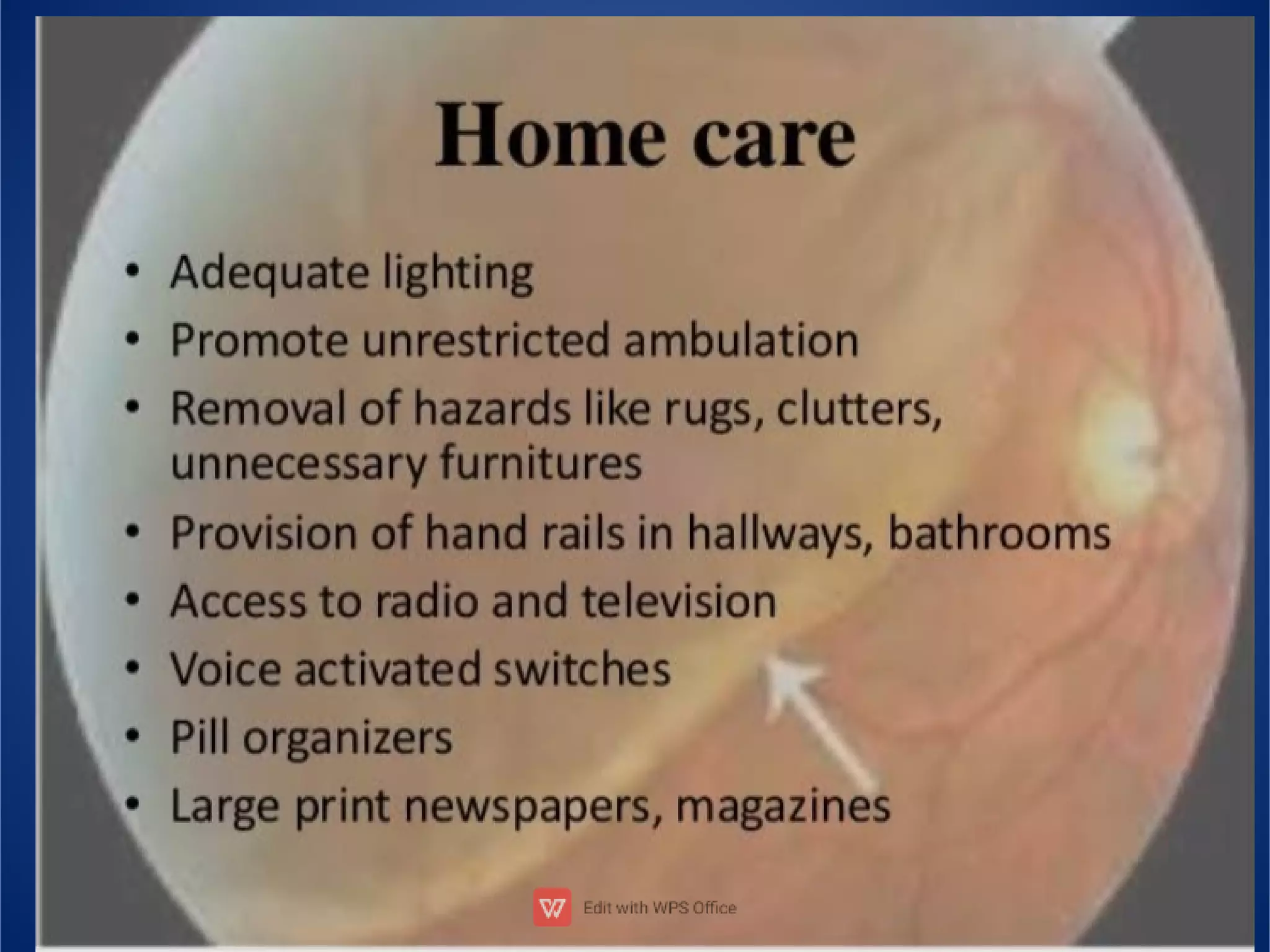 Retinal detachment presentation | PDF