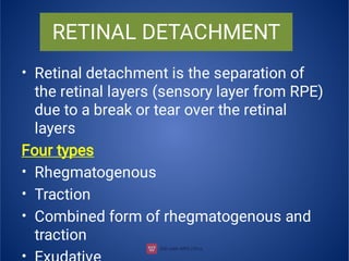 Retinal detachment presentation | PDF