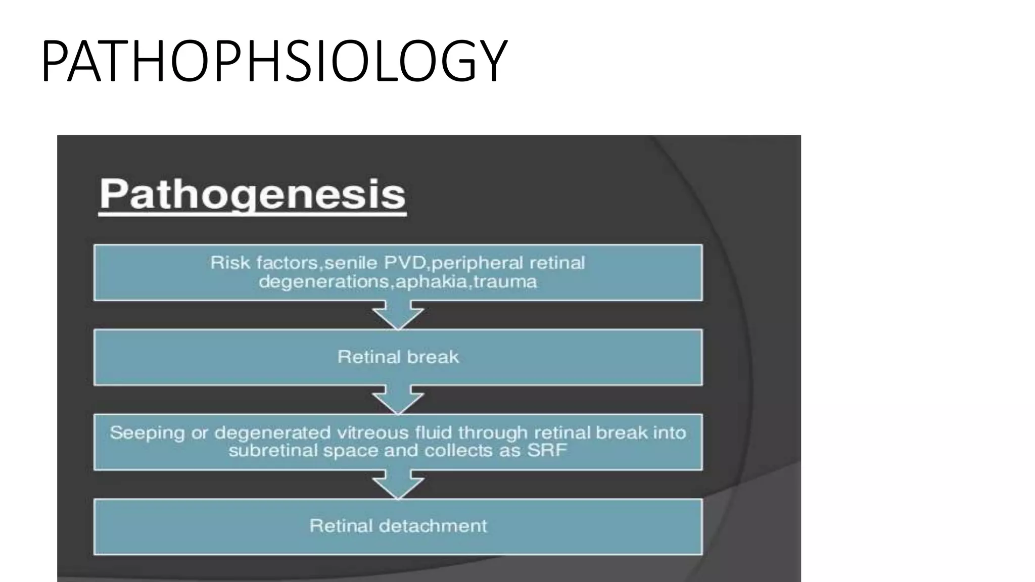 Retinal detachment | PPTX