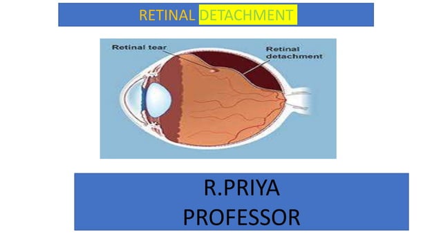 Retinal detachment | PPTX | Eye and Vision Conditions | Diseases and Conditions