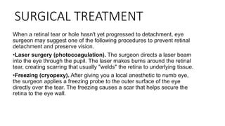 Retinal detachment | PPTX