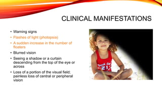 Retinal detachment | PPTX
