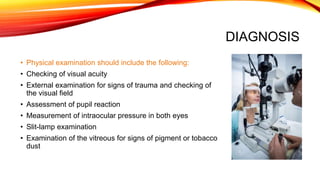 Retinal detachment | PPTX