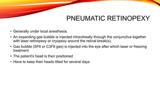 Retinal detachment | PPTX