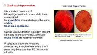 Retinal detachment | PPTX