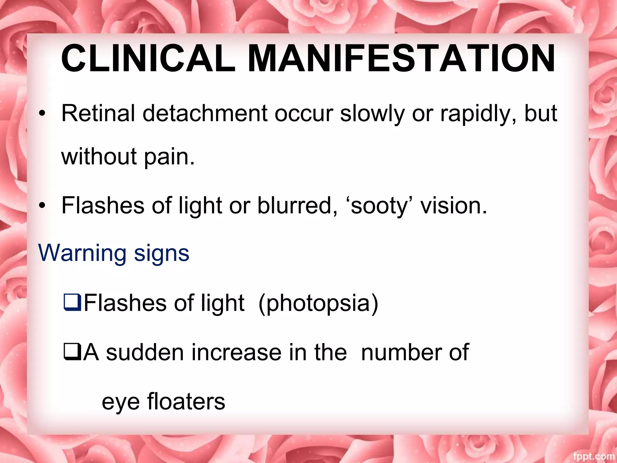 Retinal detachment | PPT