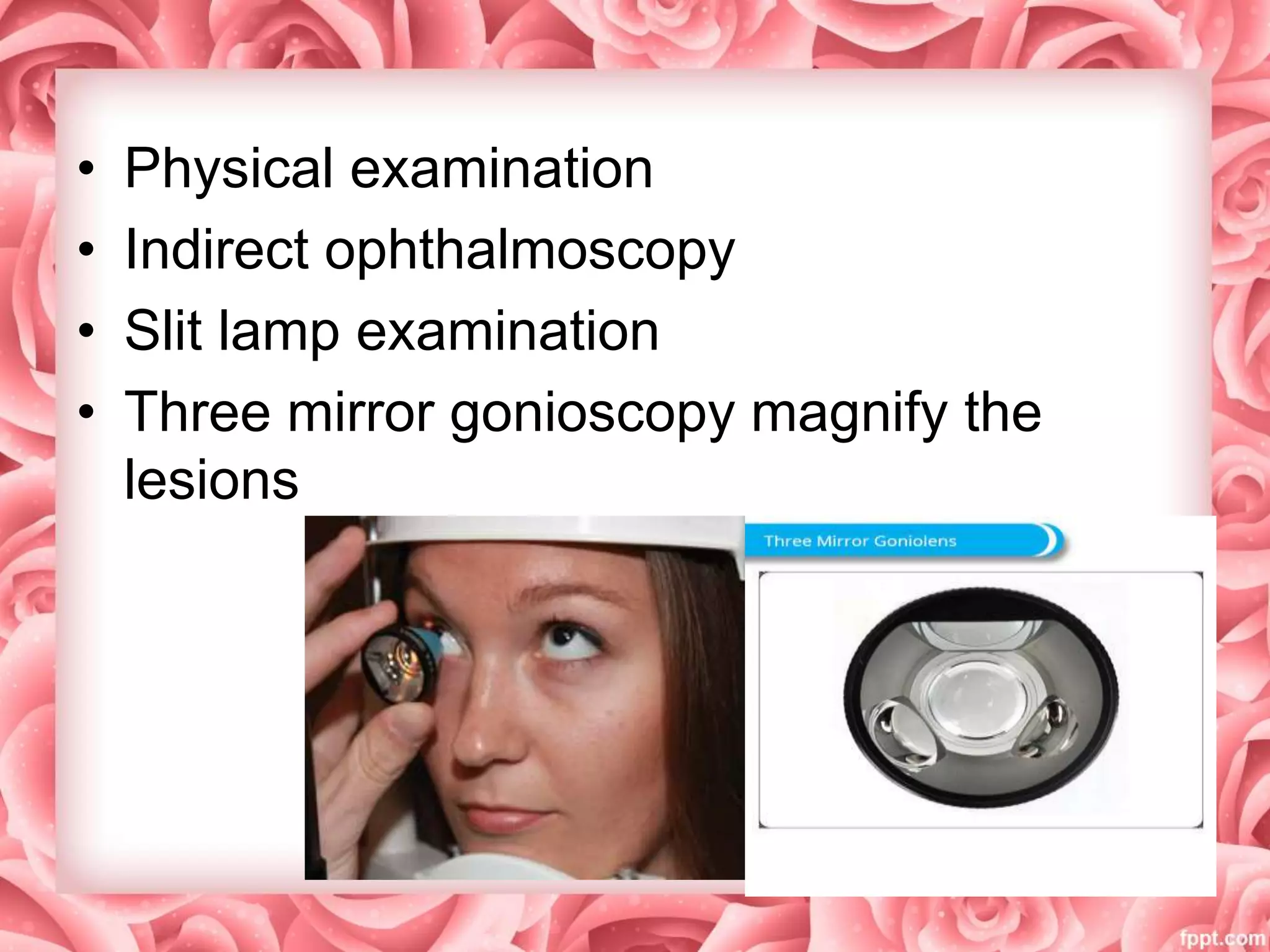 Retinal detachment | PPT