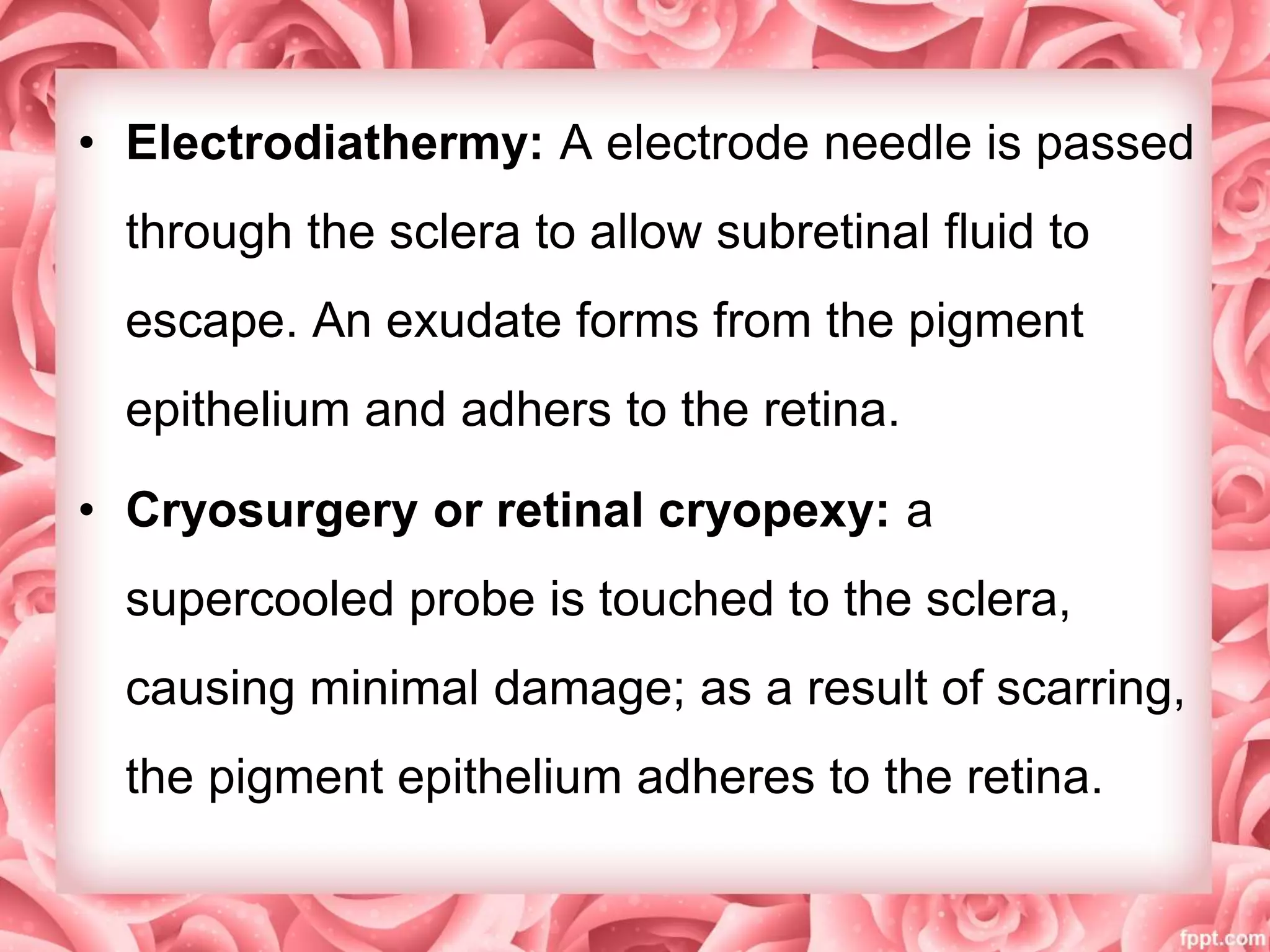 Retinal detachment | PPT