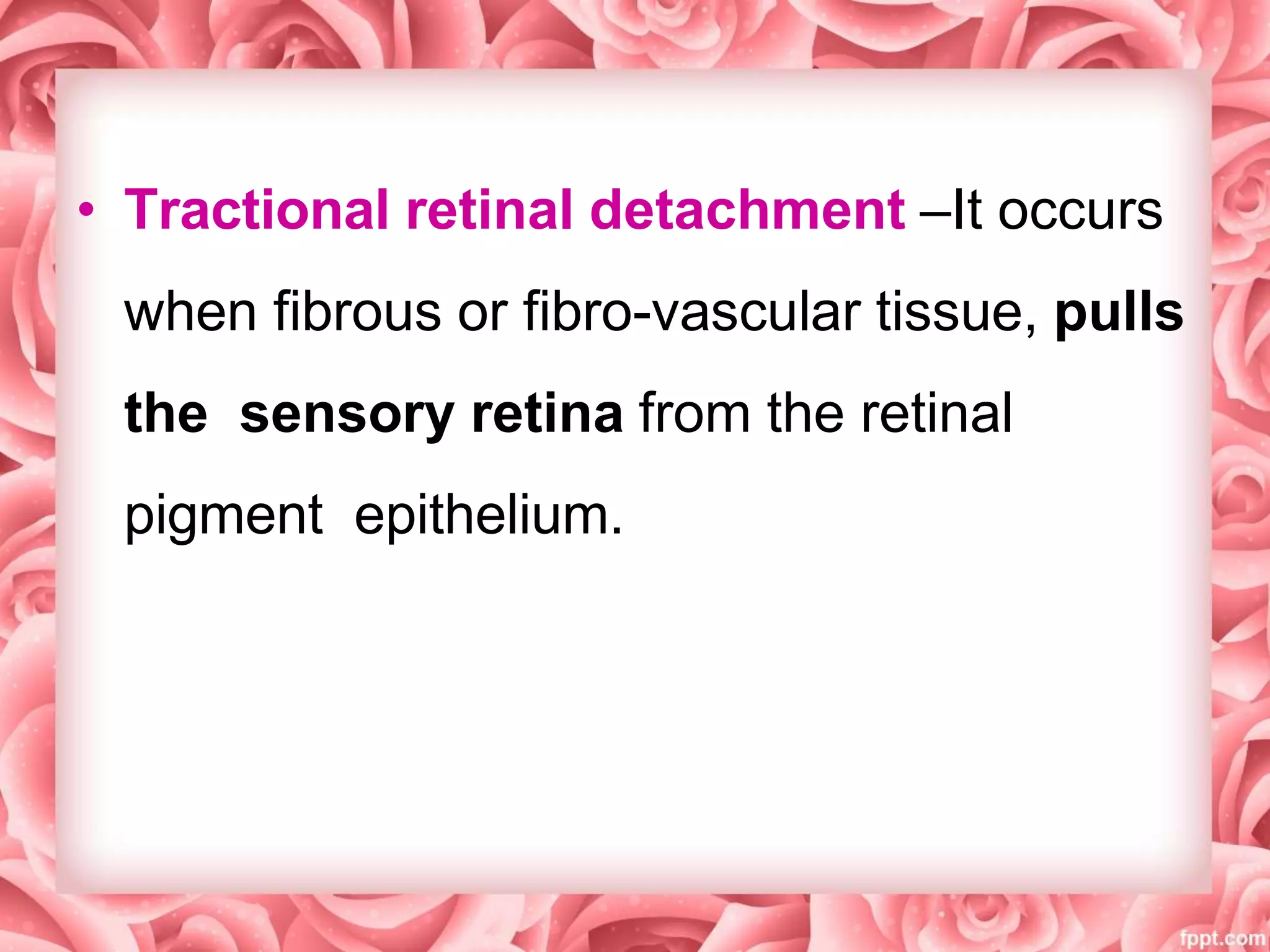 Retinal detachment | PPT