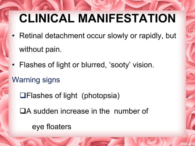 Retinal detachment | PPT