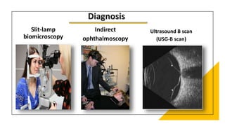 Retinal detachment | PPTX