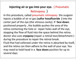 retinal detachment.pdf