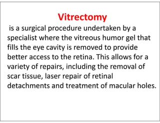 retinal detachment.pdf