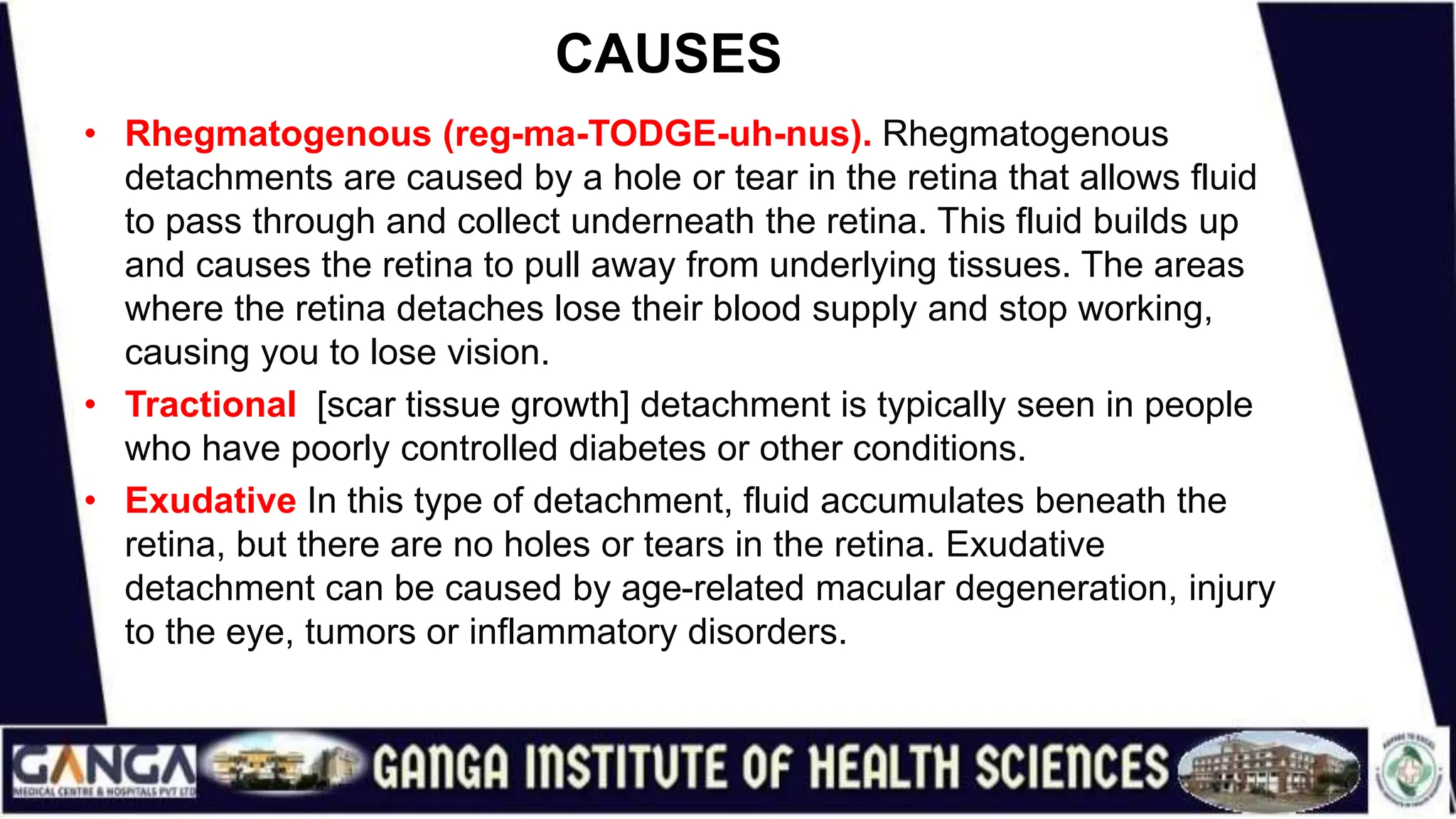 retinal detachment and its management for nursing students | PPTX