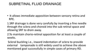 RETINAL DETACHMENT - final.pptx | Eye and Vision Conditions | Diseases ...