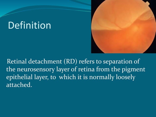 Retinal detachment | PPTX | Eye and Vision Conditions | Diseases and Conditions