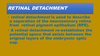 Retinal detachment 2016 | PPTX