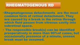 Retinal detachment 2016 | PPTX