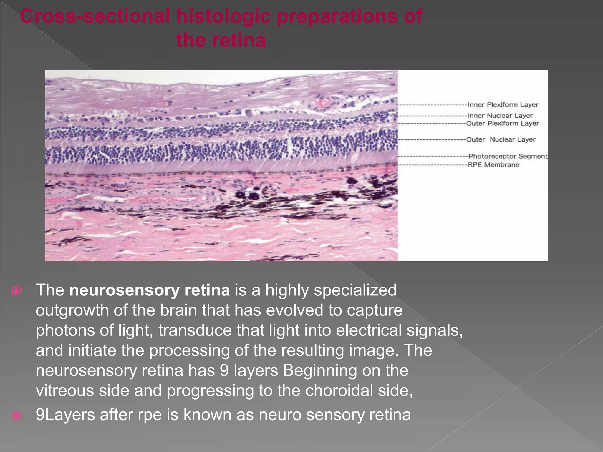 Retinal detachment | PPTX