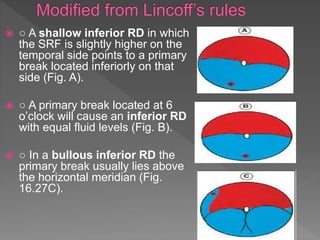 Retinal detachment | PPTX