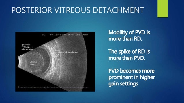 Management of retinal detachment