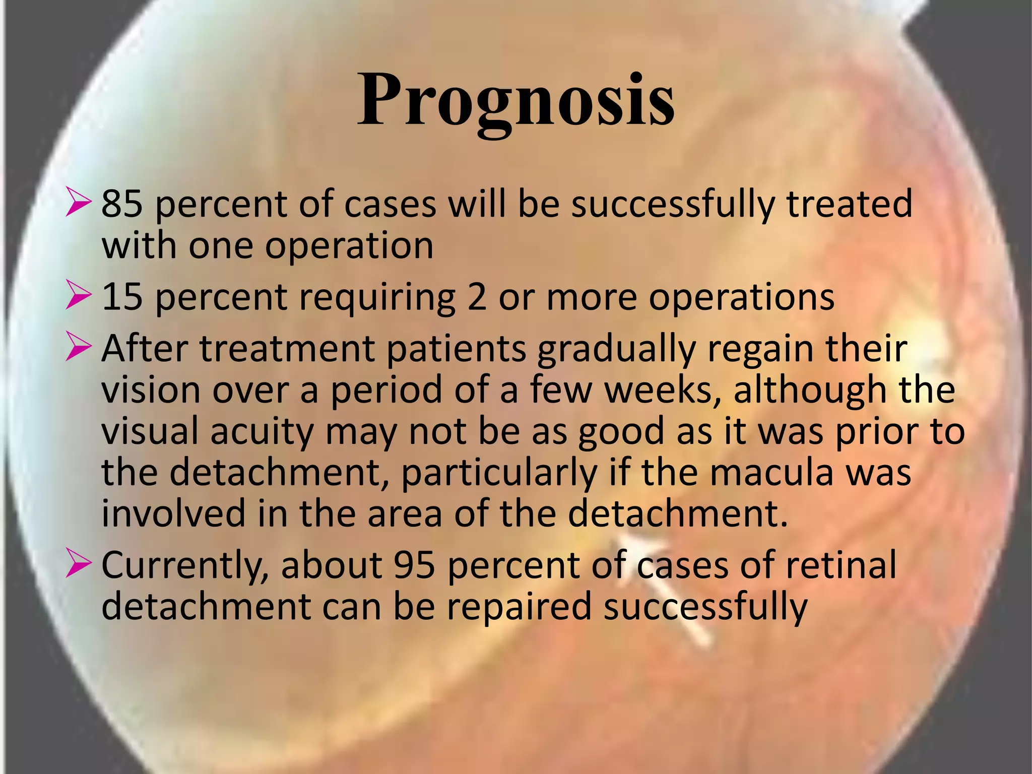 Retinal detachment new | PPTX