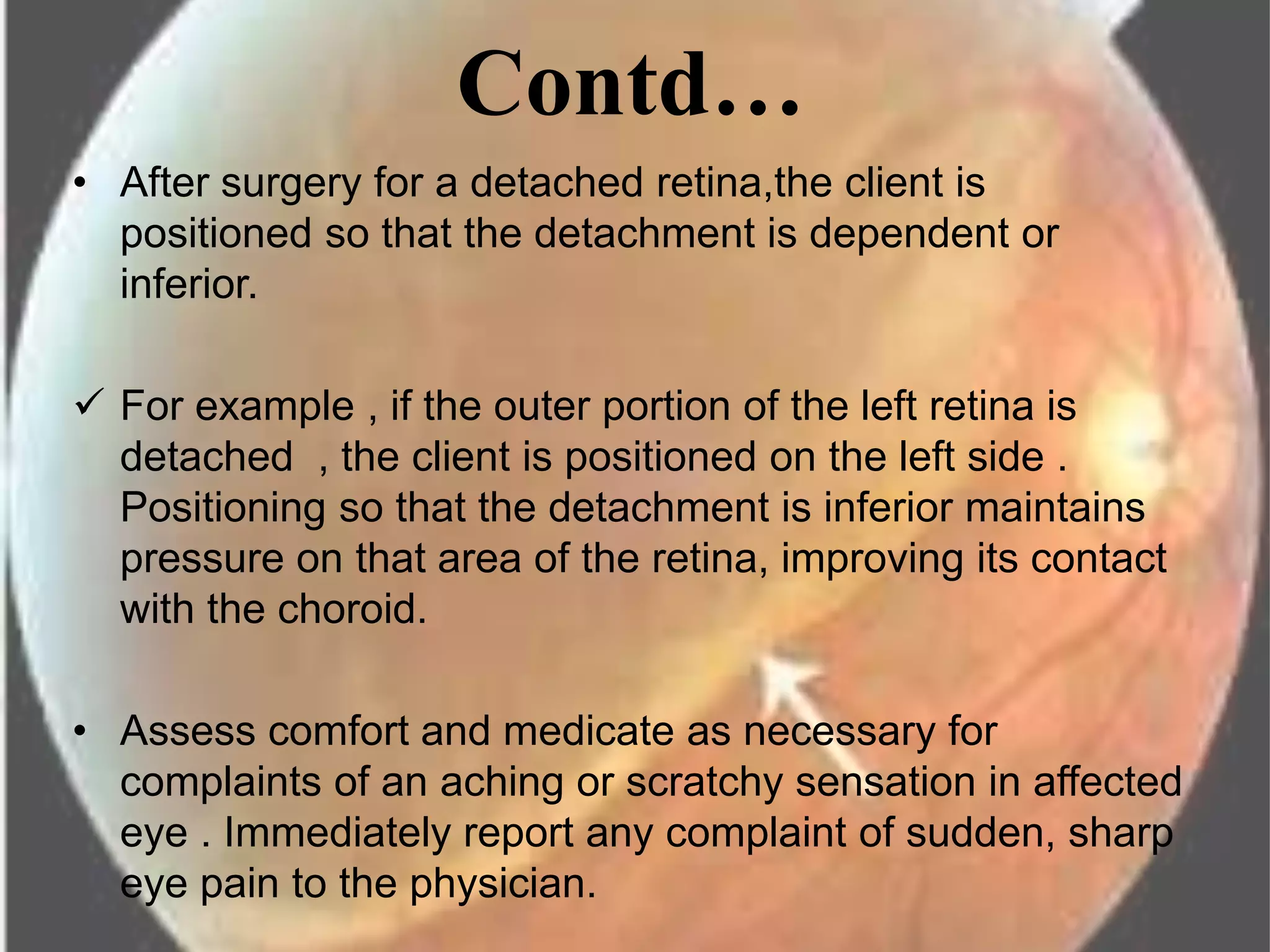 Retinal detachment new | PPTX