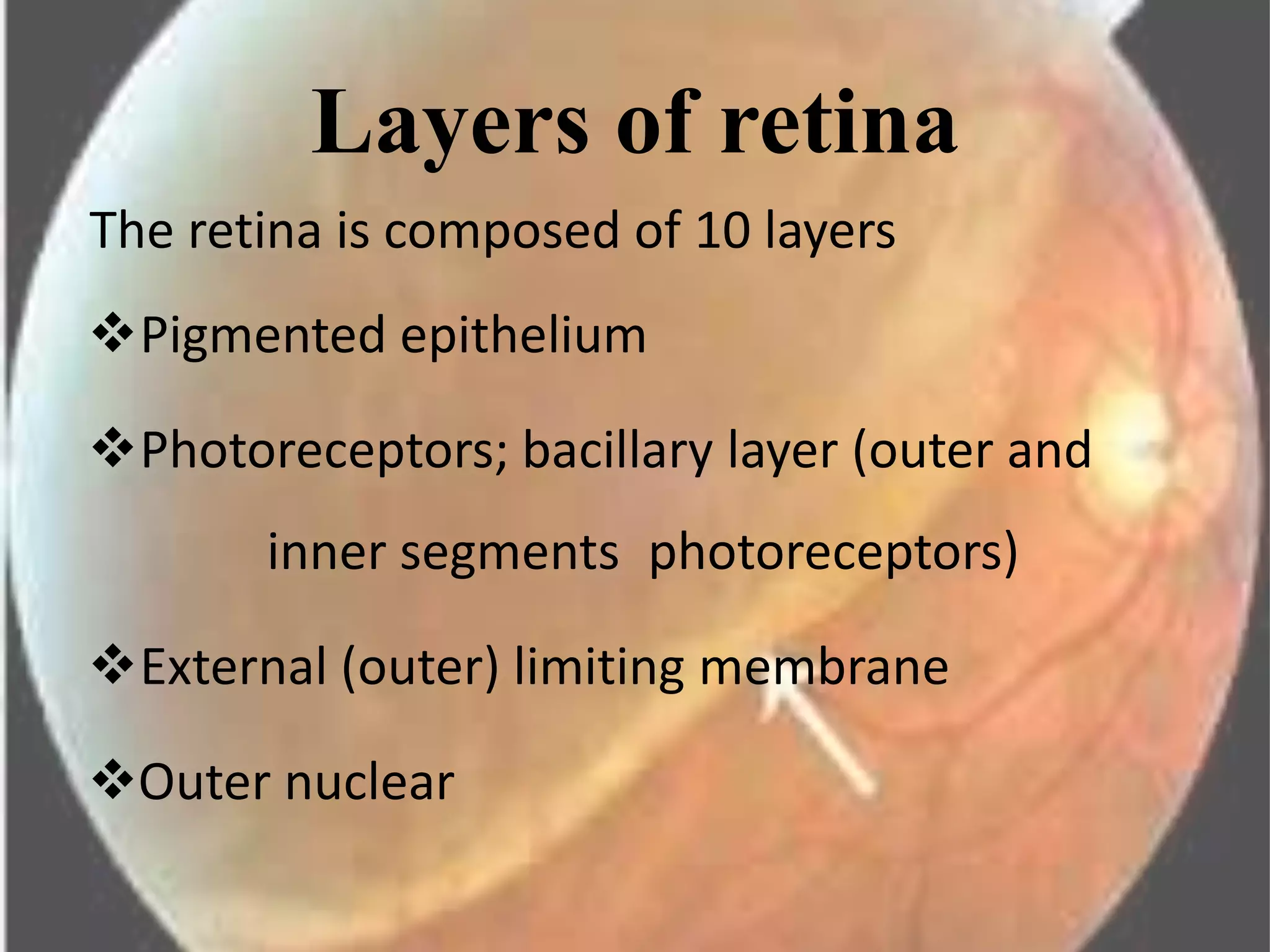 Retinal detachment new | PPTX