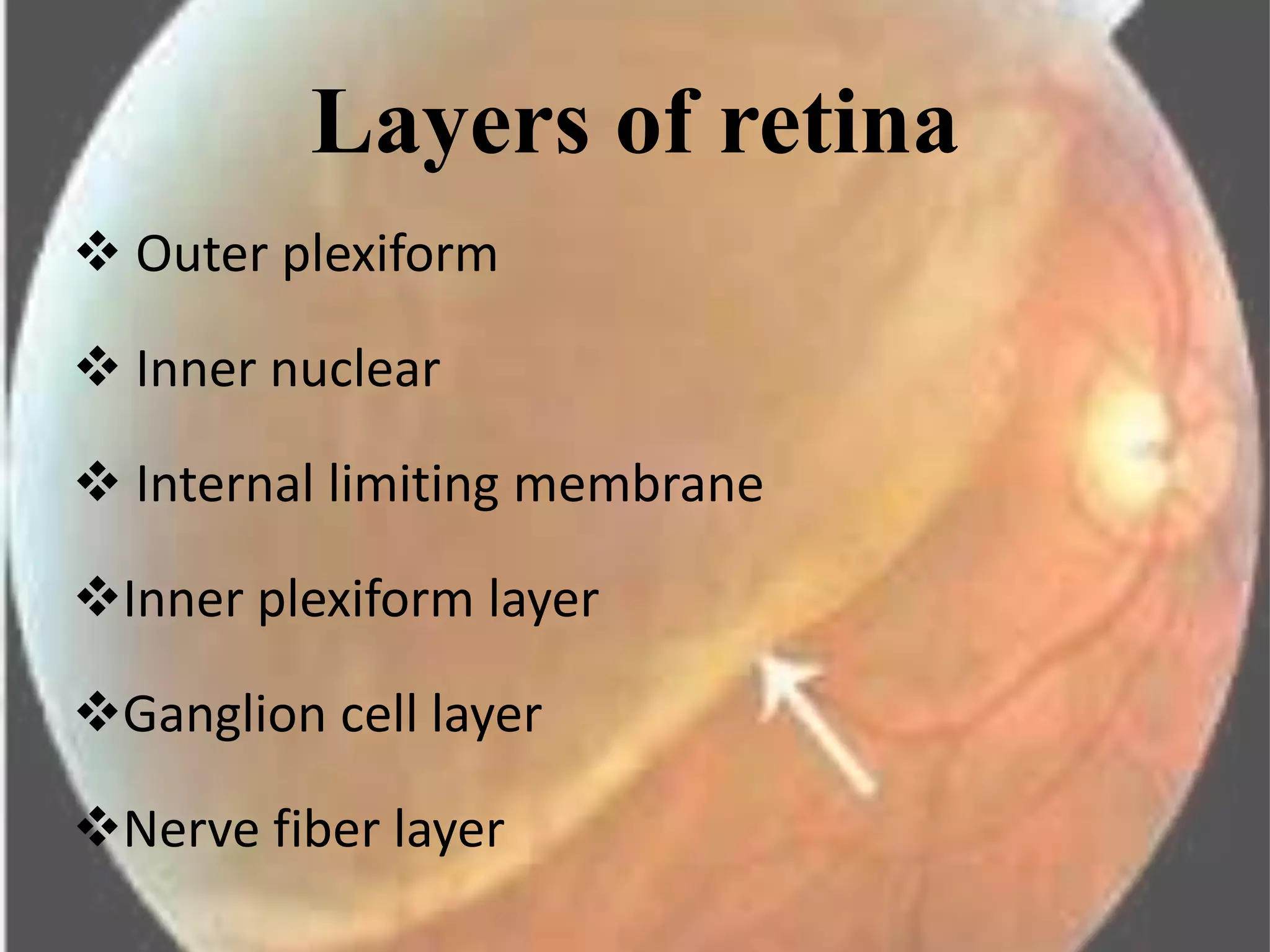 Retinal detachment new | PPTX