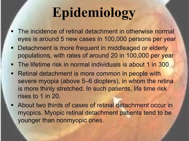 Retinal detachment new | PPTX