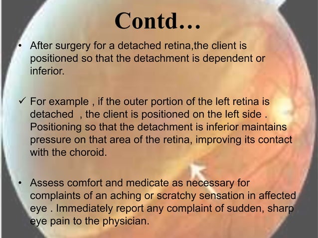 Retinal detachment new | PPTX