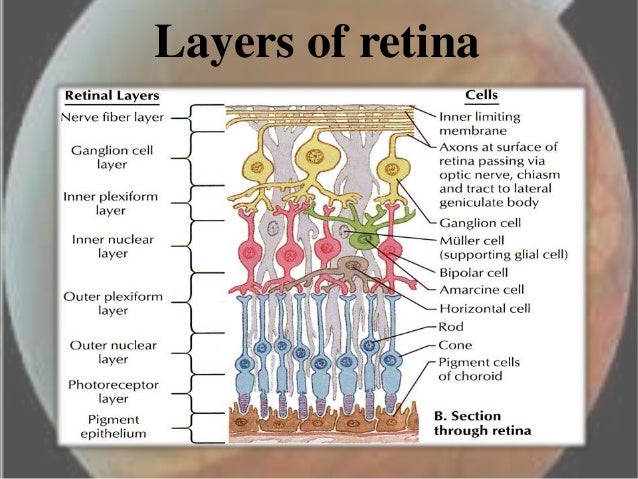 Detached Retina Diagram