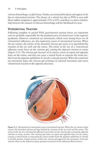 Retinal Detachment Principles and Practice 3rd Ed.pdf