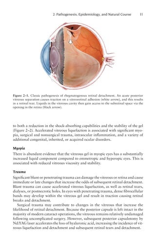 Retinal Detachment Principles and Practice 3rd Ed.pdf