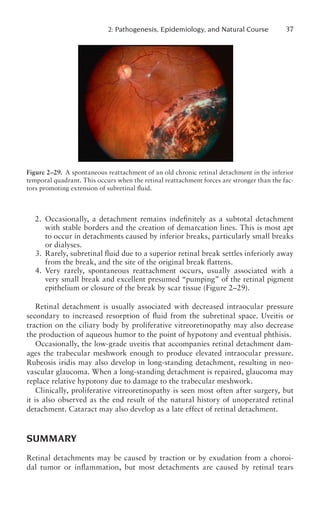 Retinal Detachment Principles and Practice 3rd Ed.pdf