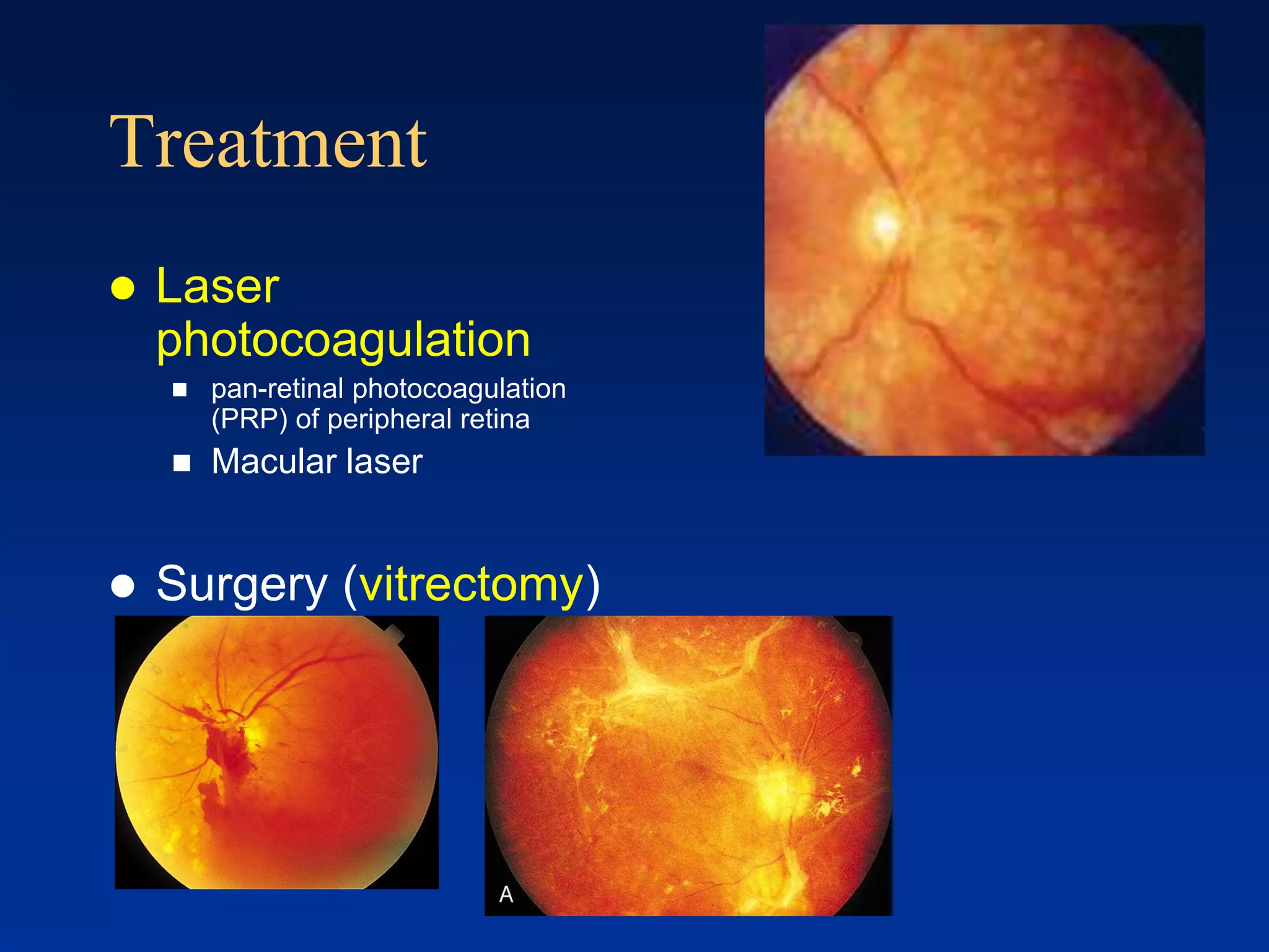 Retinal disease lecture. Optometry. Optometri. | PPT