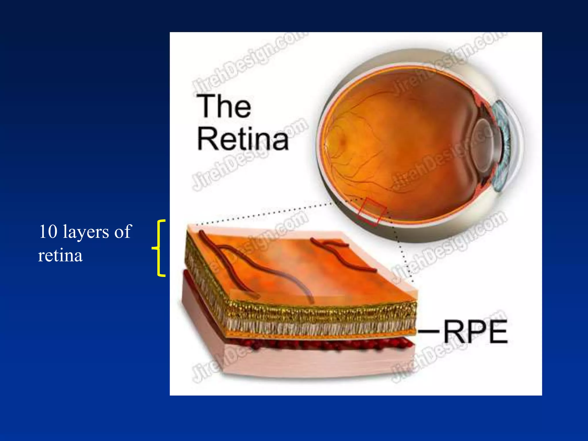 Retinal disease lecture. Optometry. Optometri. | PPT