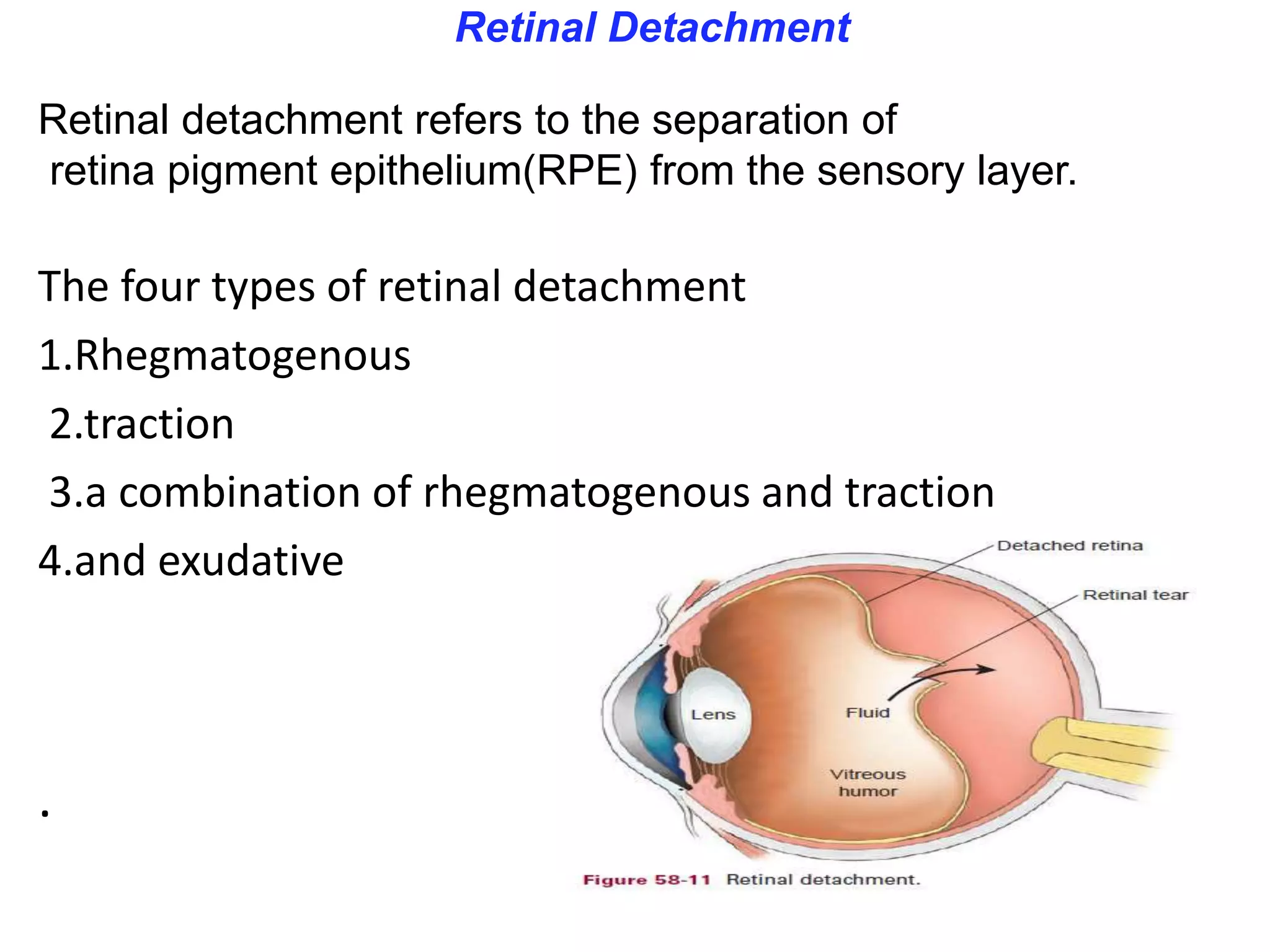 Retinal disorders | PPTX