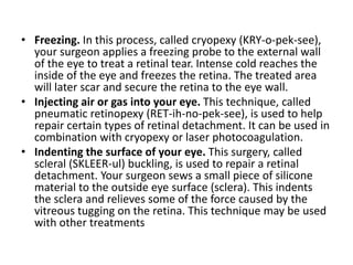 Retinal disorders | PPTX