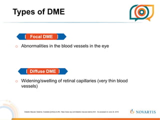 Retinal disorders DME | PPTX