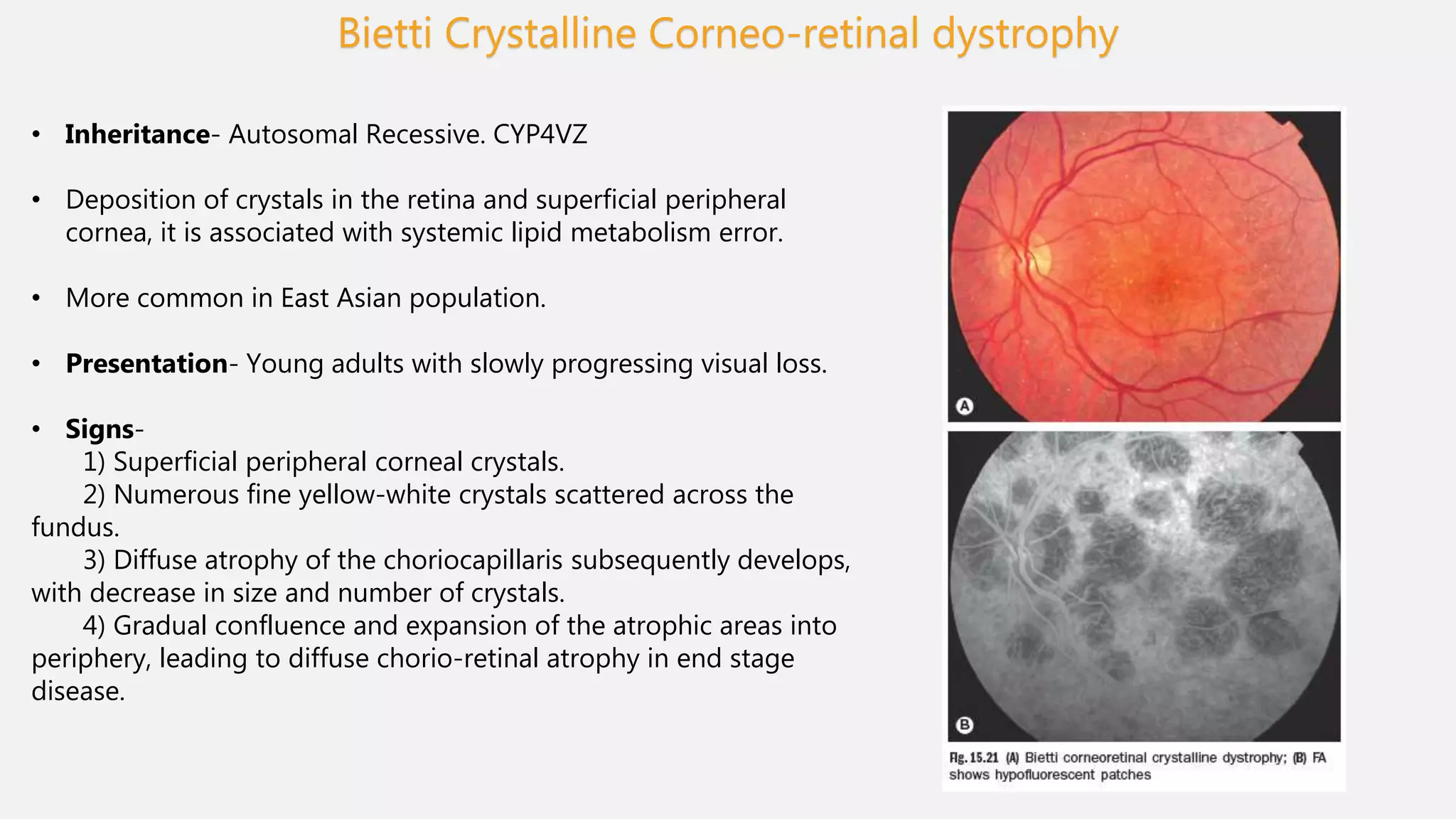 Retinal dystrophy | PPTX
