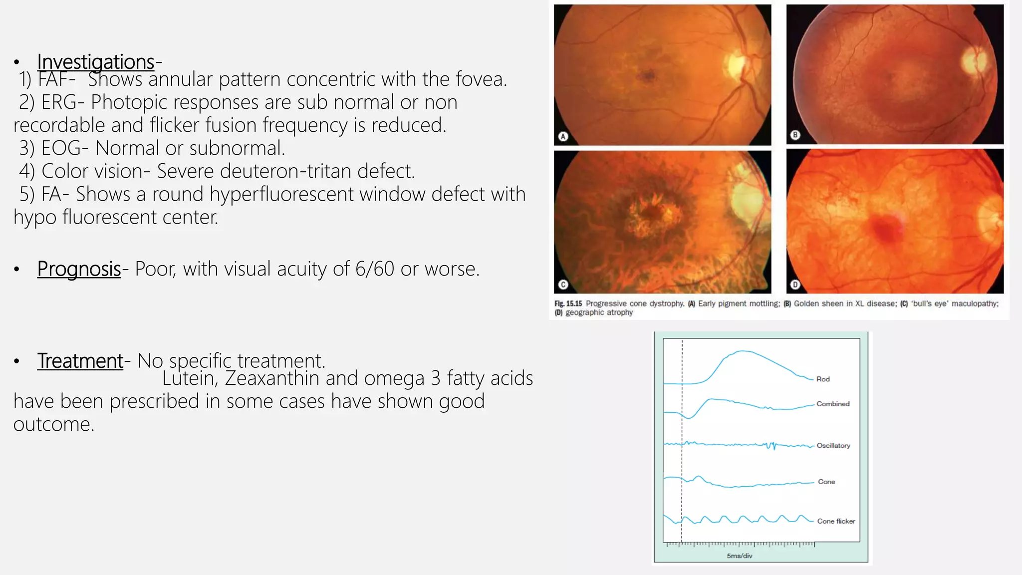 Retinal dystrophy | PPTX