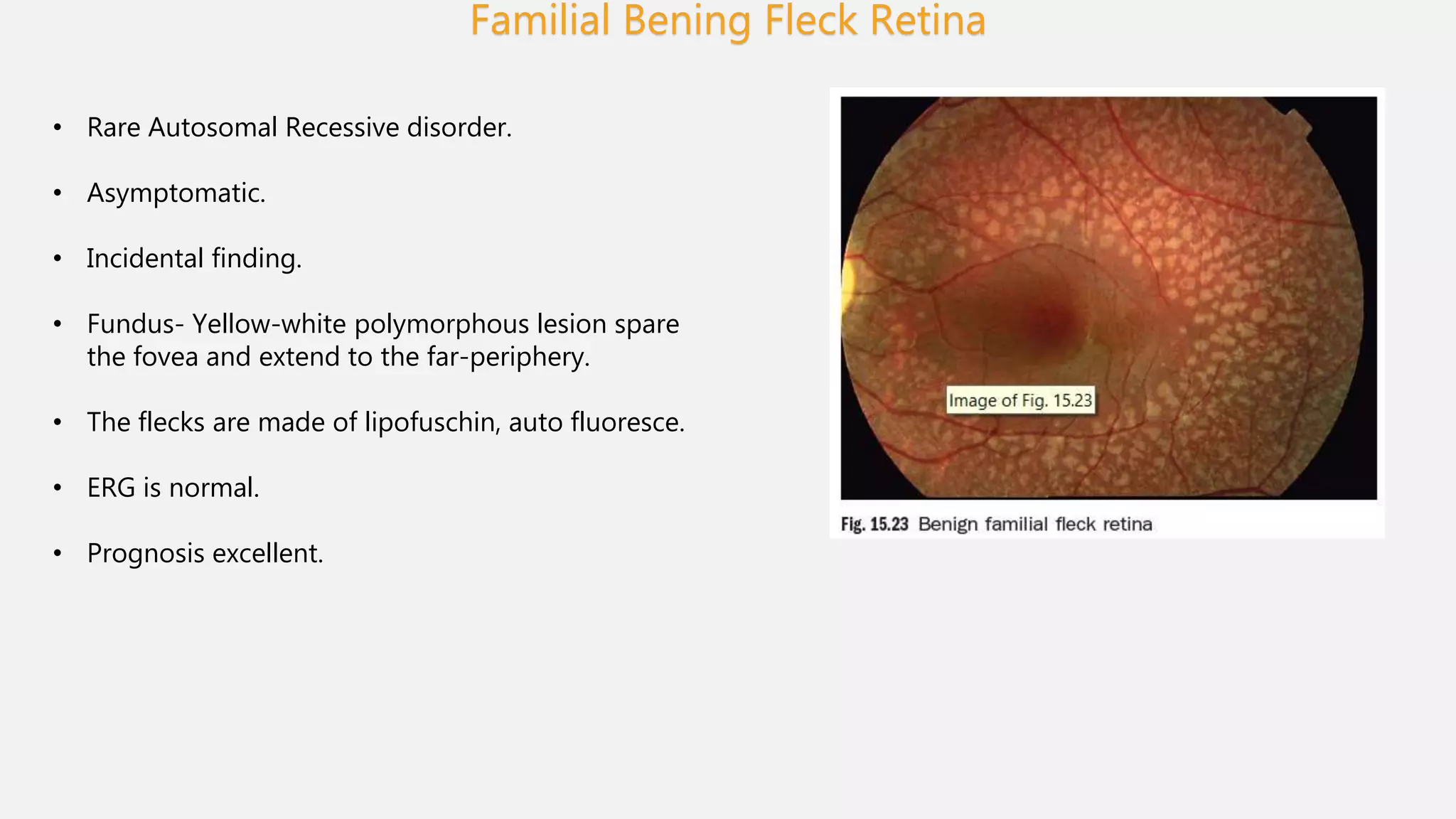 Retinal dystrophy | PPTX